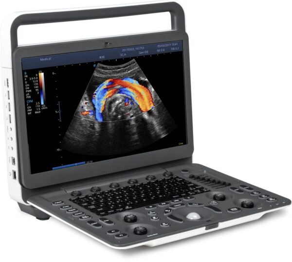 Ultrazvuk SonoScape P9 Elite | Medical Centar