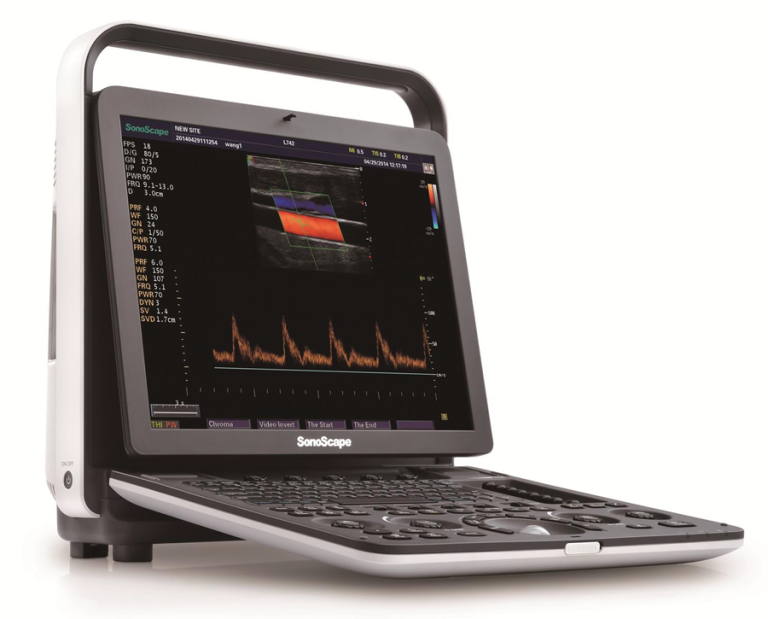 Ultrazvuk SonoScape P9 – novi model! | Medical Centar