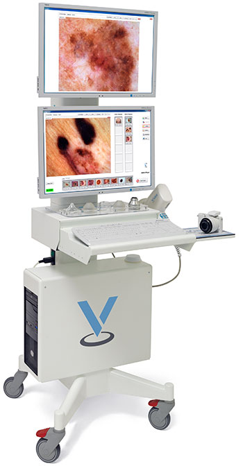 Videodermatoskop sa Body mappingom | Medical Centar