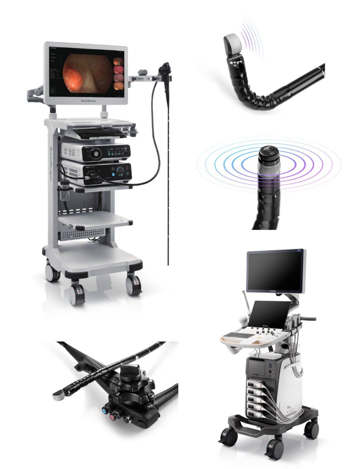 Endoskopski ultrazvuk (EUS) SonoScape | Medical Centar